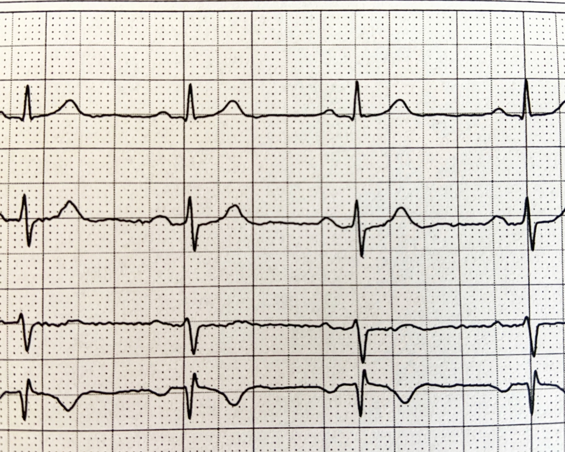 Das bringt das EKG der Apple Watch und anderer Medizin-Apps
